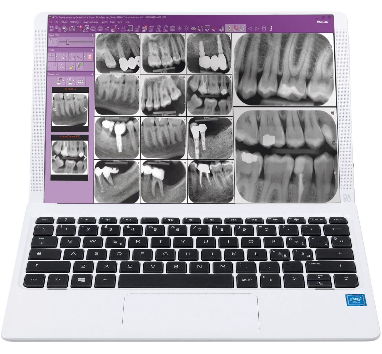 IRYS Software Imaging Odontoiatrico Integrato | Anthos